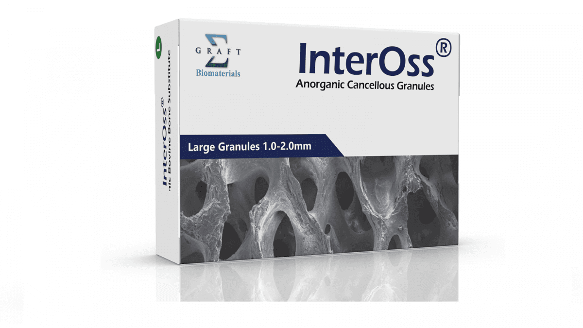 Top 5 Bone Graft Materials in Dentistry - Dental Country™